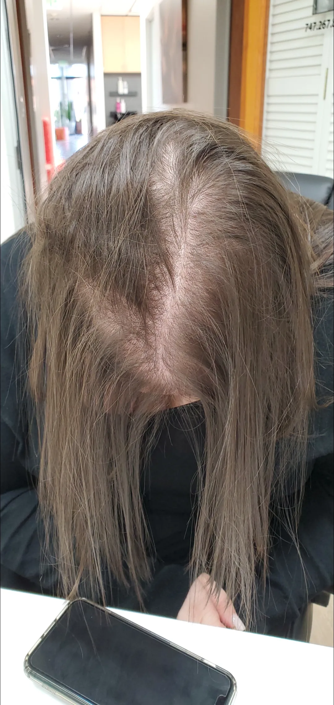 Scalp Micropigmentation in Los Angeles | HairDot.Ink