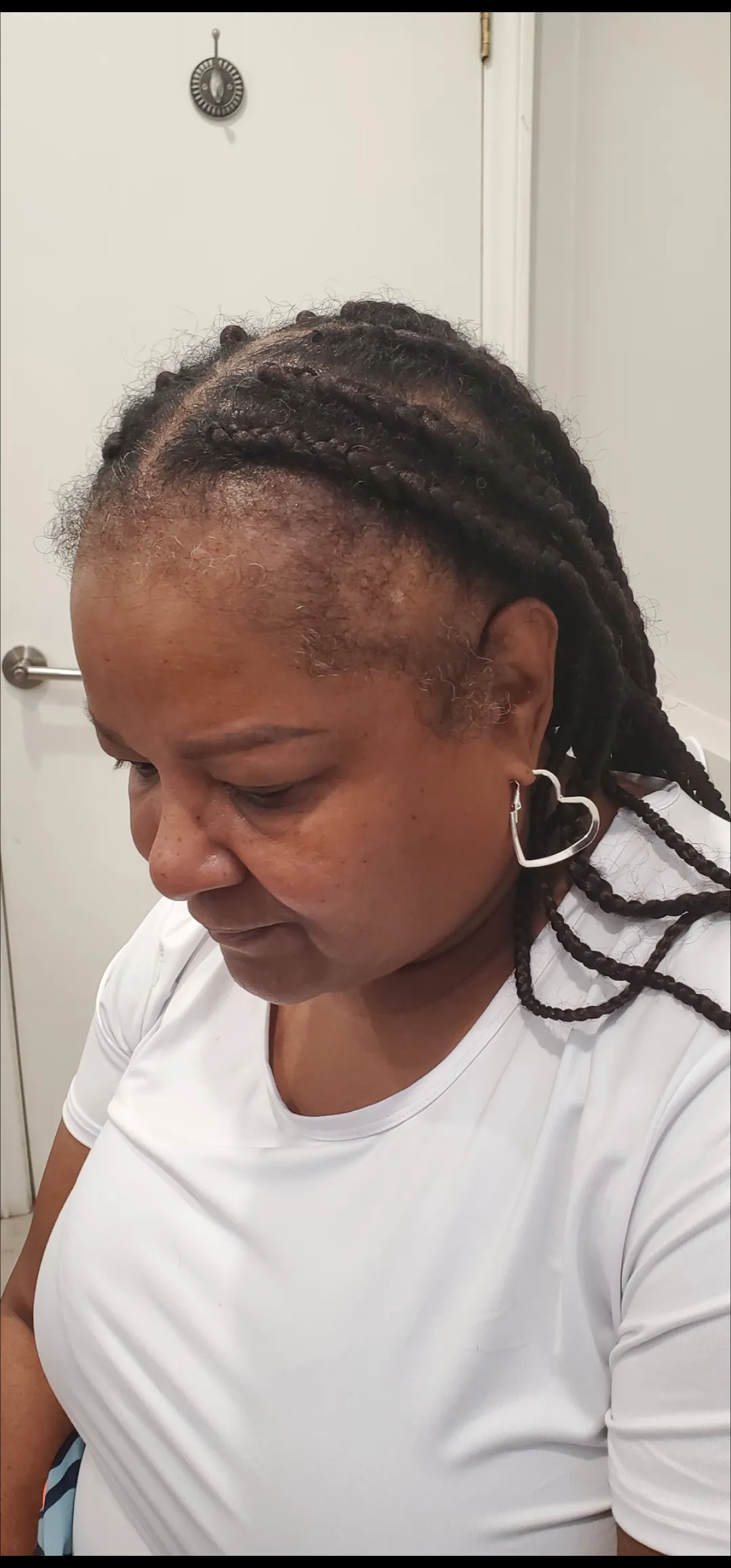 Scalp Micropigmentation in Los Angeles | HairDot.Ink