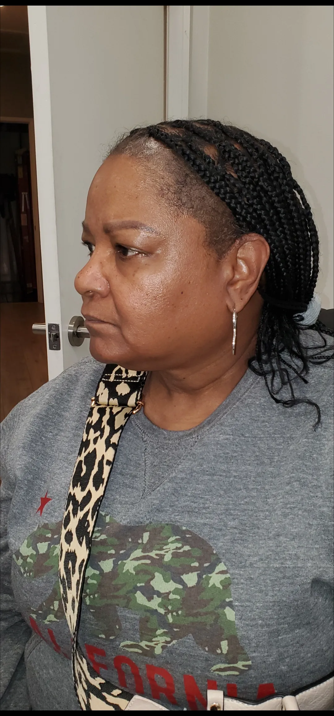 Scalp Micropigmentation in Los Angeles | HairDot.Ink