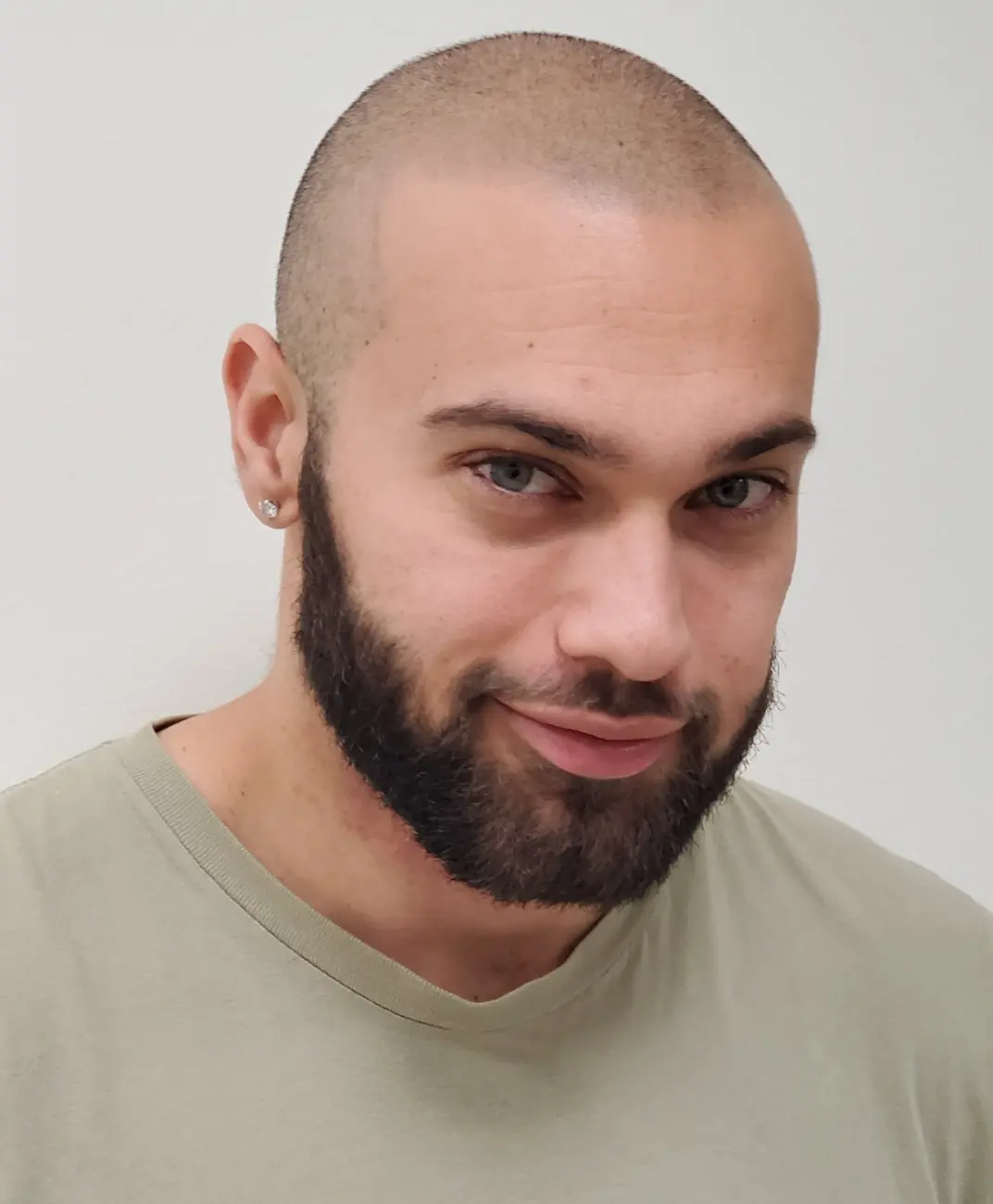 Scalp Micropigmentation in Los Angeles | HairDot.Ink